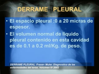 Derrame pleural | PPTX