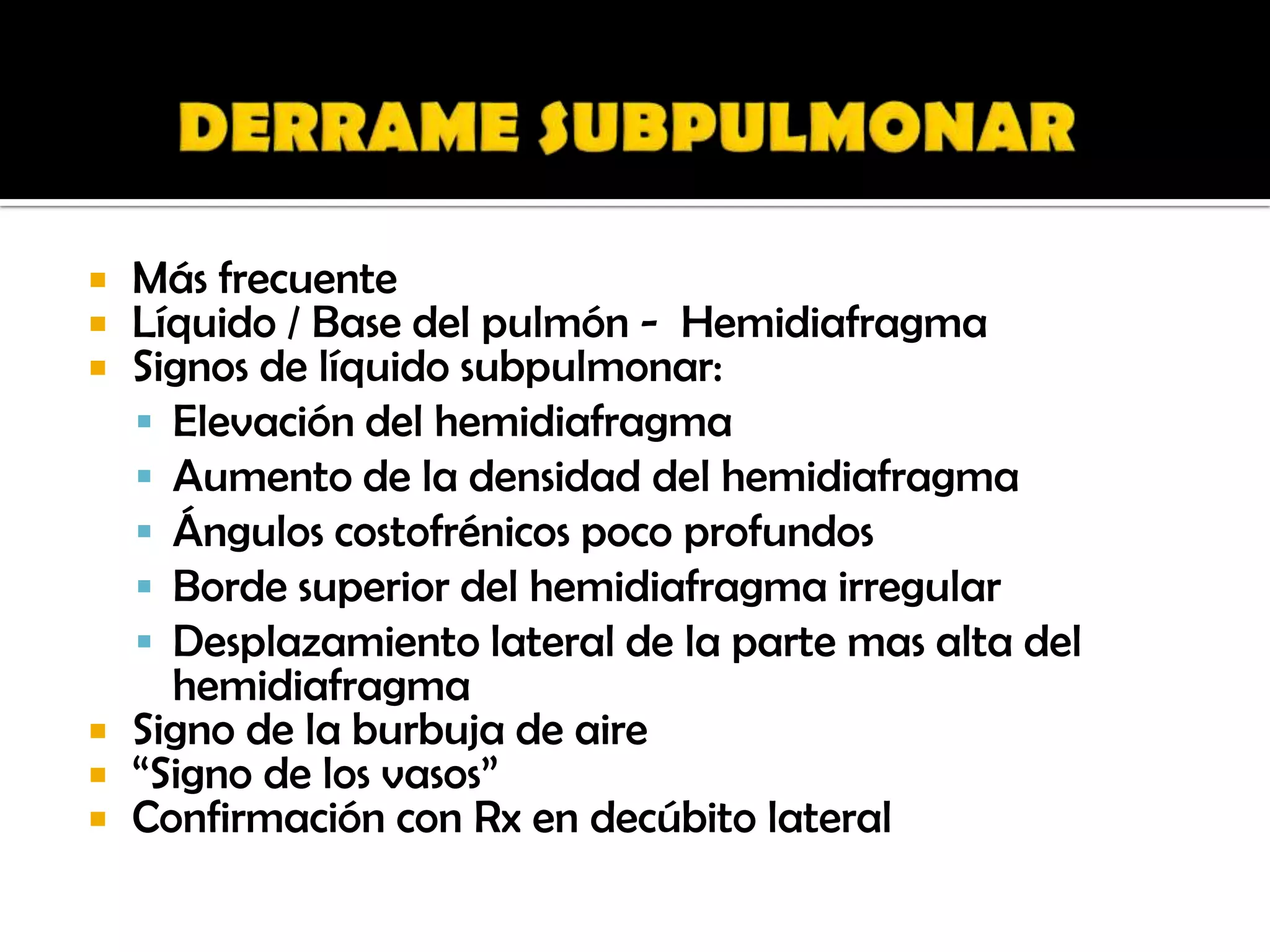 Derrame pleural | PPTX
