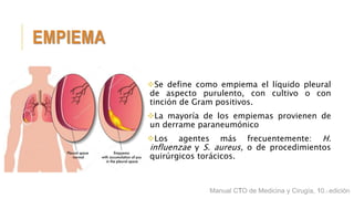 Derrame pleural | PPTX