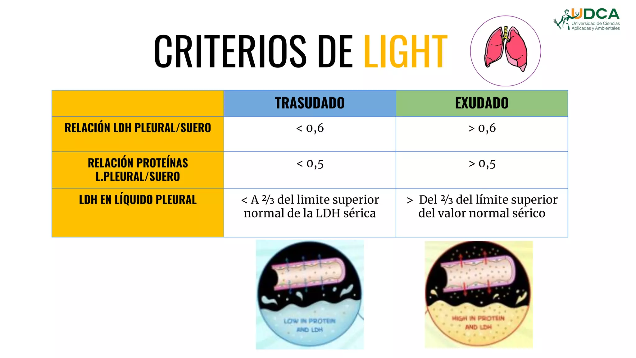 Derrame pleural - Medicina Interna | PDF