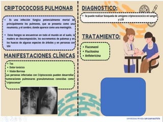 Comprehensive Overview of Pleural Effusion and Pulmonary Mycosis in ...