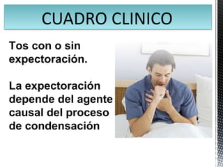DERRAME PLEURAL Y ATELECTASIAS | PPTX