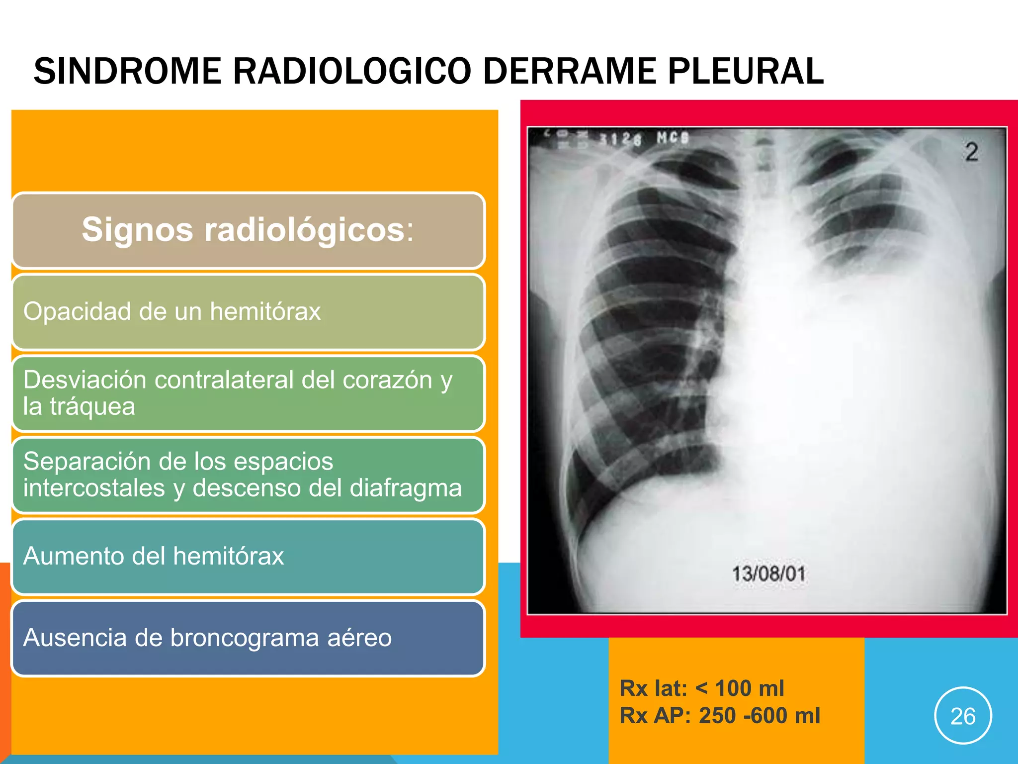 Derrame pleural y neumotorax 2019 by Md Graciela Cordova. UMSS | PPTX