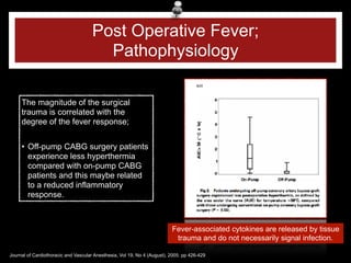post operative fever infectious and non- | PDF