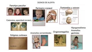DESARROLLO PSICOMOTOR Y SIGNOS ALARMA.pdf
