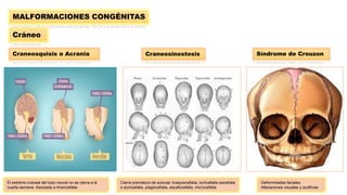 Desarrollo sistema esquelético y malformaciones Vladimir Elvio Humerez ...