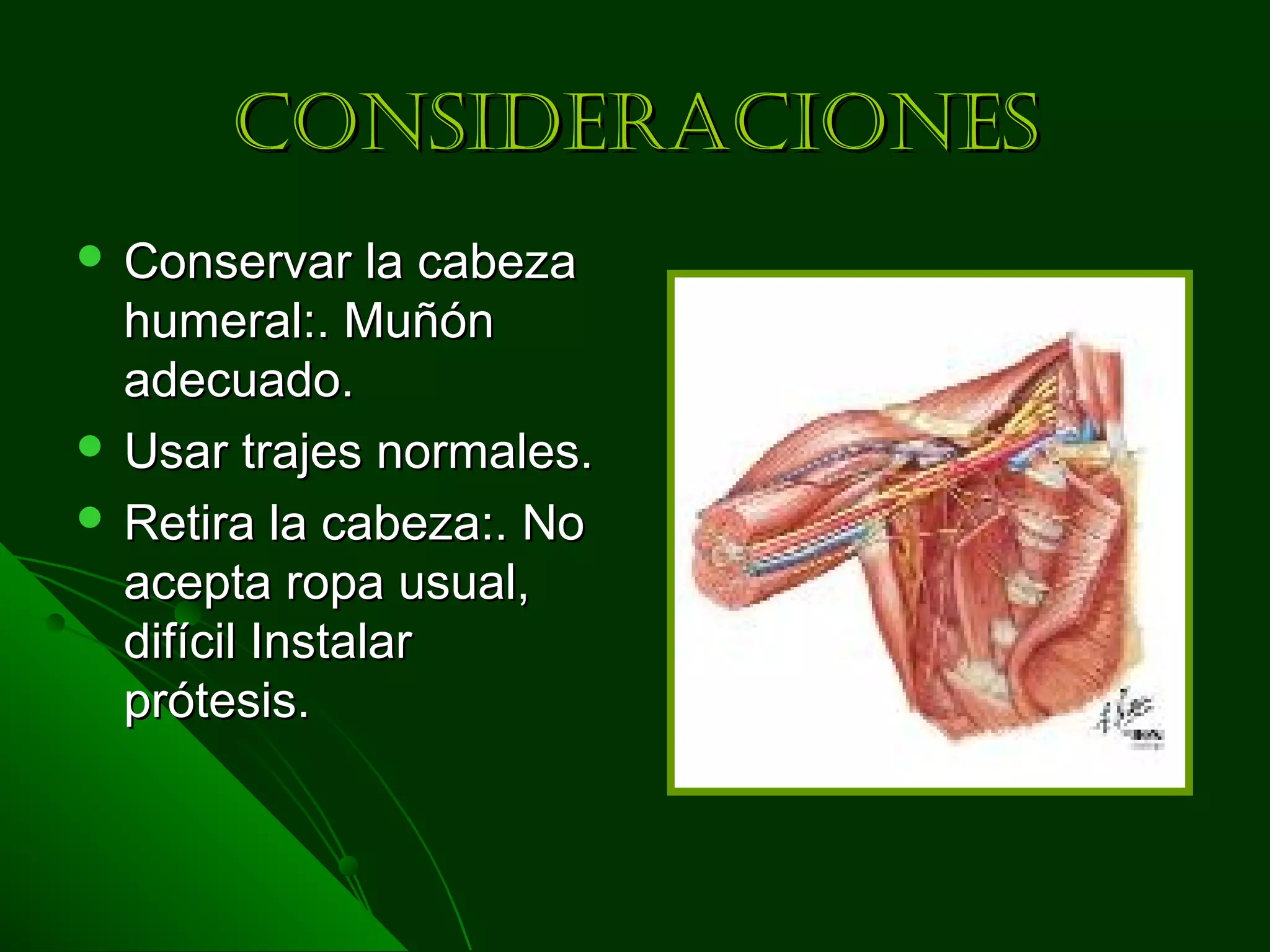 Desarticulacion de hombro y escapulo toracica | PPT