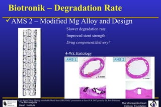Des bioabsorbable stents tct 2010 | PPT