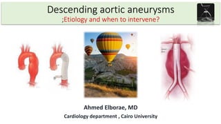 Descending aortic aneurysm | PDF