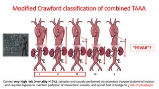 Descending aortic aneurysm | PDF