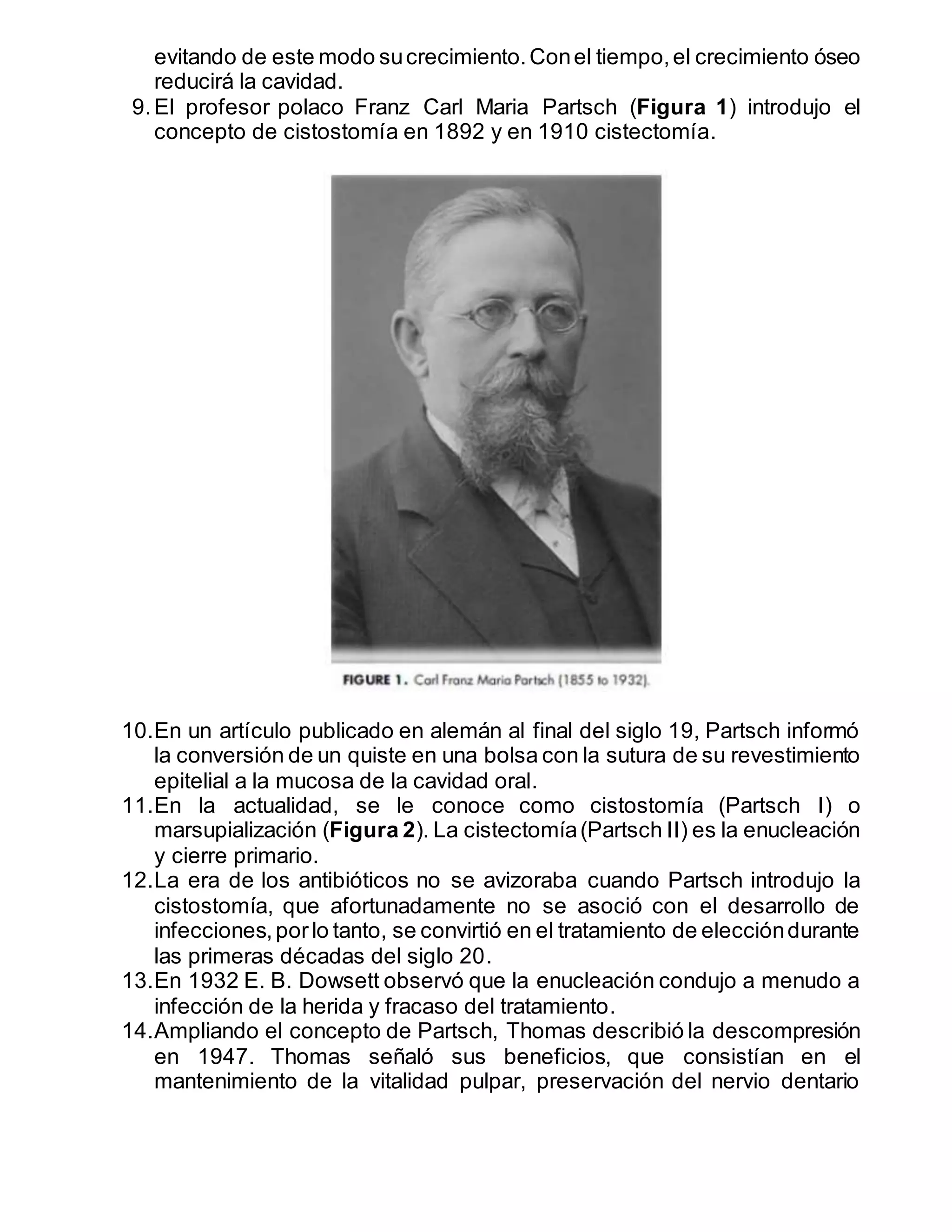 DESCOMPRESION DE LOS QUISTES ODONTOGENICOS: PASADO, PRESENTE Y FUTURO ...