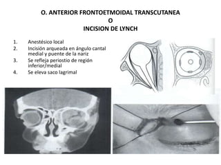 Descompresión Orbitaria.pptx