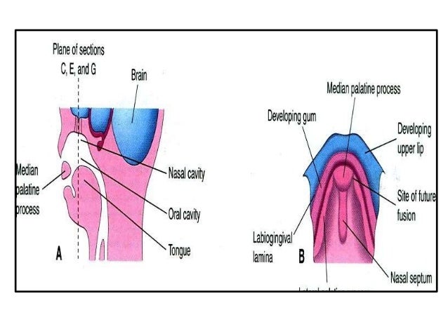 palate formation - amjad al.bleahid