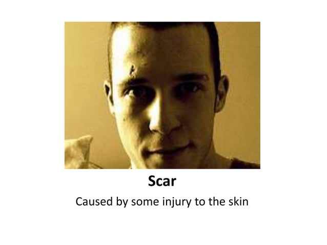 Describing a suspect | PPSX | Skin and Dermatology | Diseases and ...