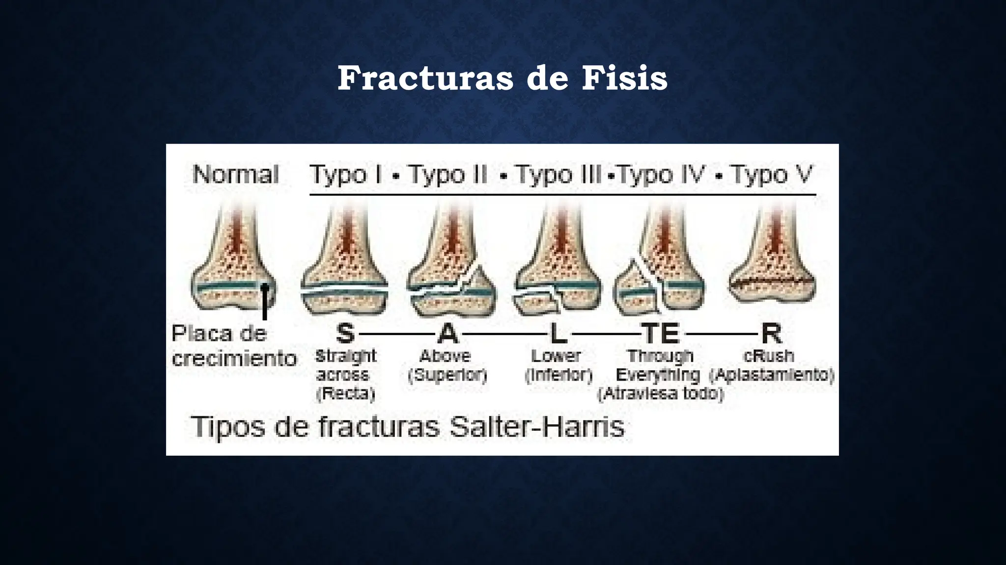 Descripción de fracturas en radiografías.pptx