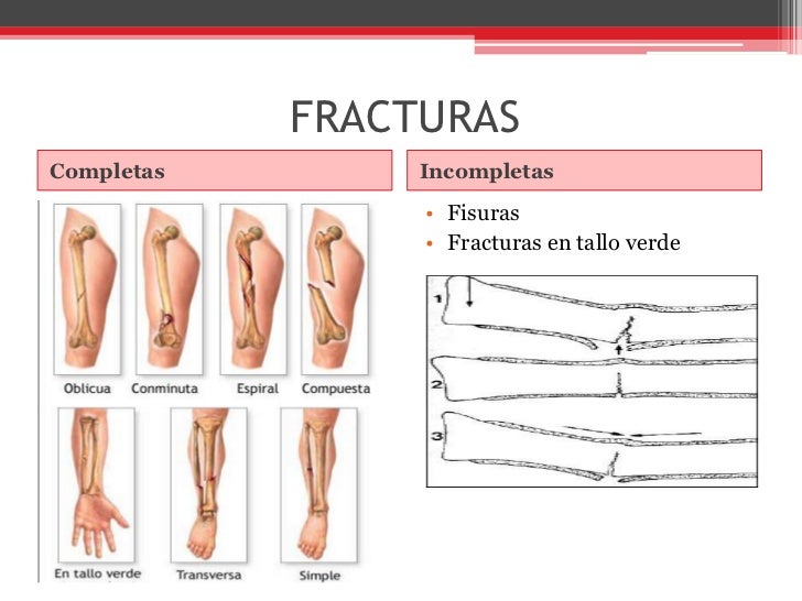 Descripcion de heridas