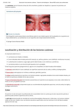 Descripción de las lesiones cutáneas - Trastornos dermatológicos ...
