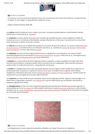 Descripción de las lesiones cutáneas - Trastornos dermatológicos ...