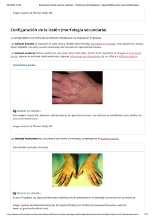 Descripción de las lesiones cutáneas - Trastornos dermatológicos ...