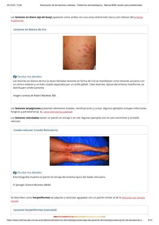 Descripción de las lesiones cutáneas - Trastornos dermatológicos ...