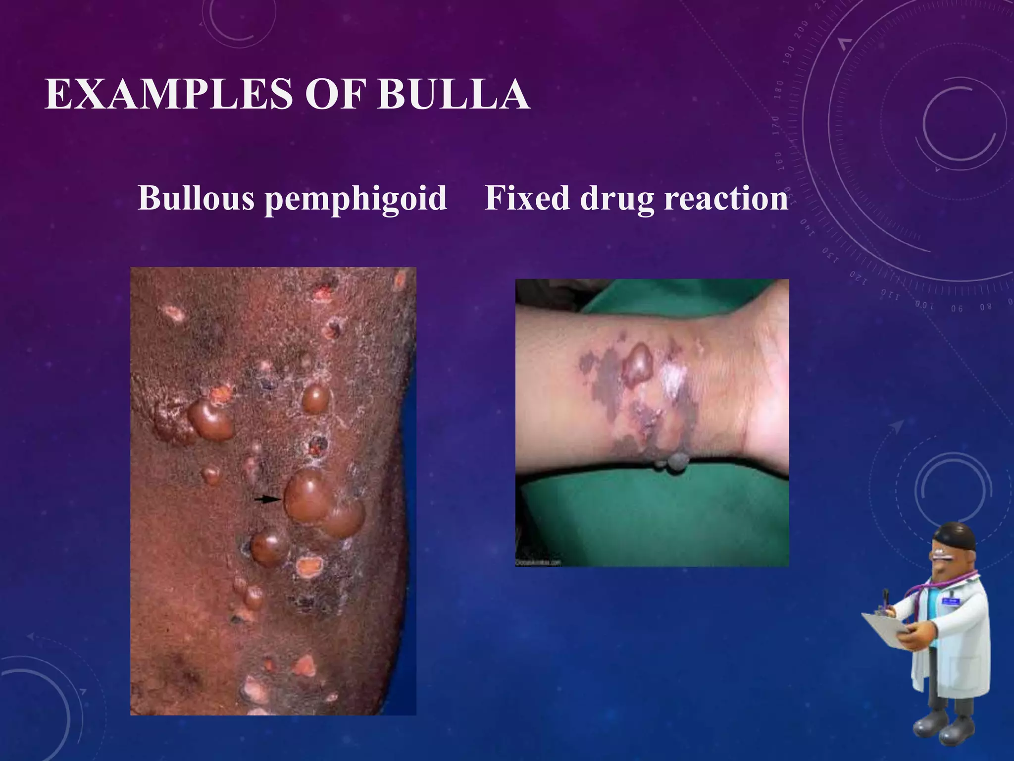Description of basic skin lesions | PPTX