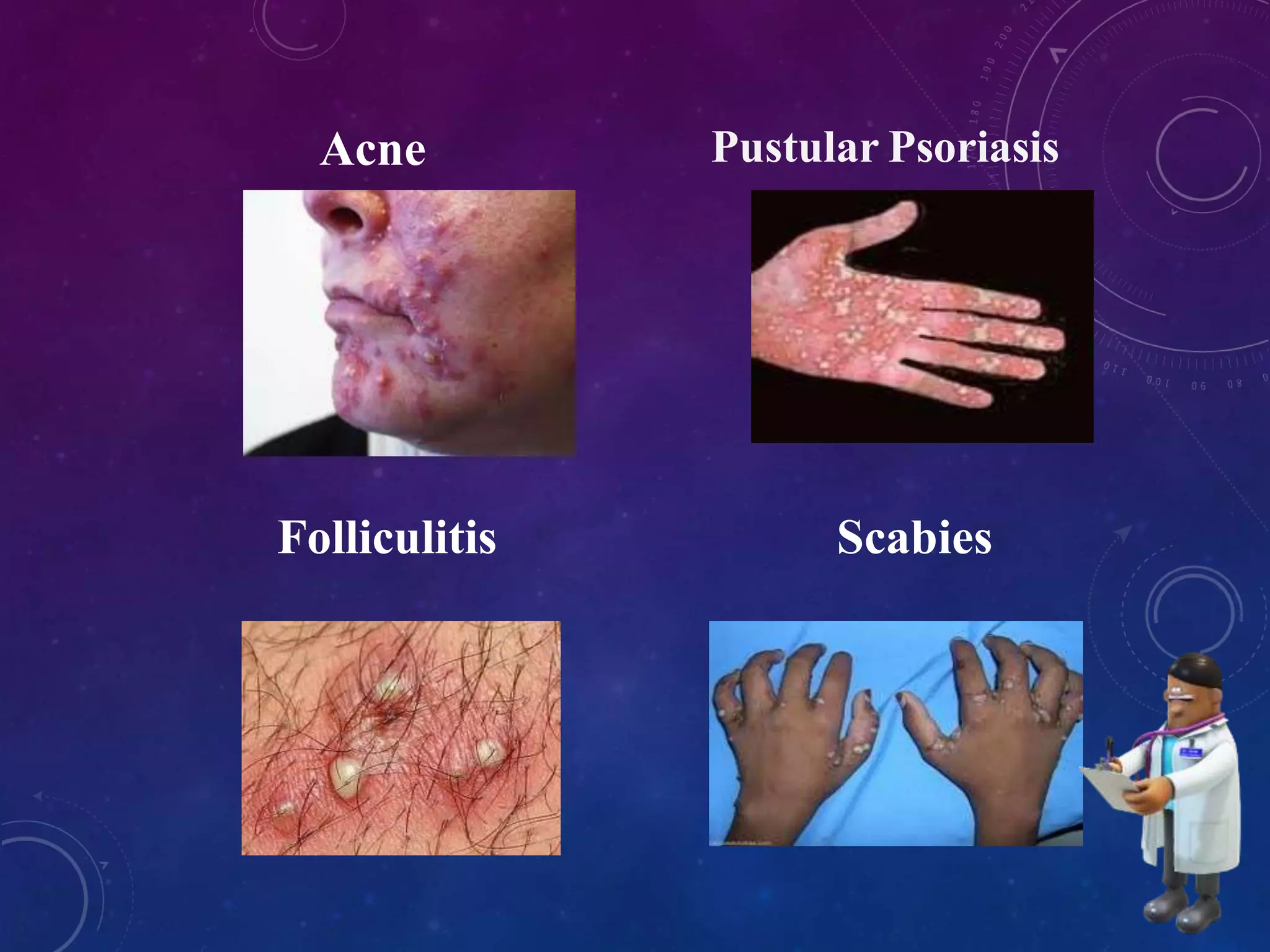 Description of basic skin lesions | PPTX