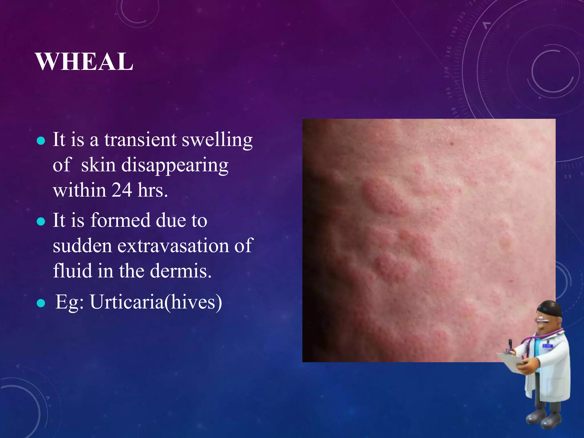 Description of basic skin lesions | PPTX