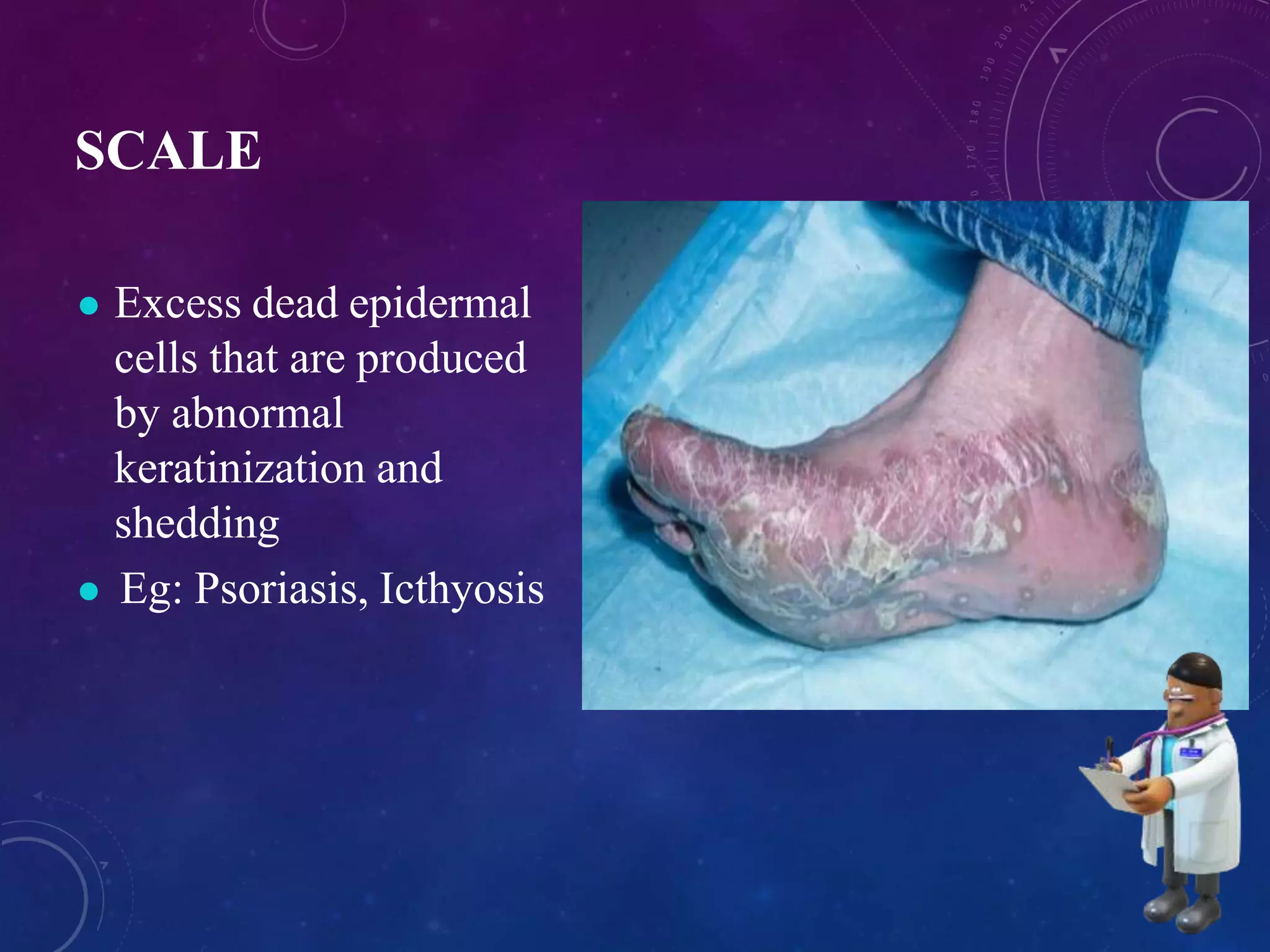 Description of basic skin lesions | PPTX