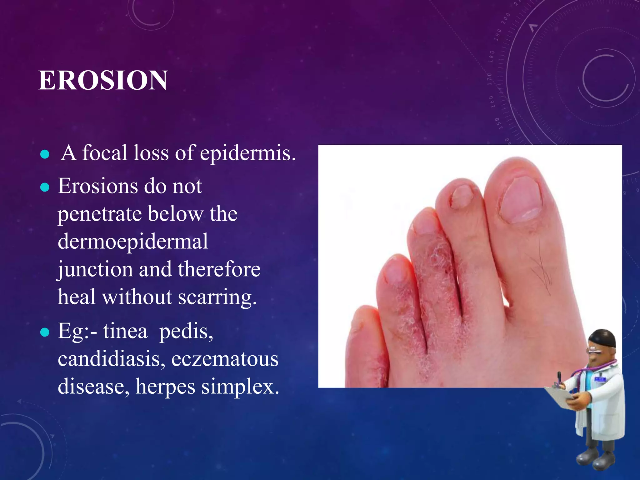 Description of basic skin lesions | PPTX