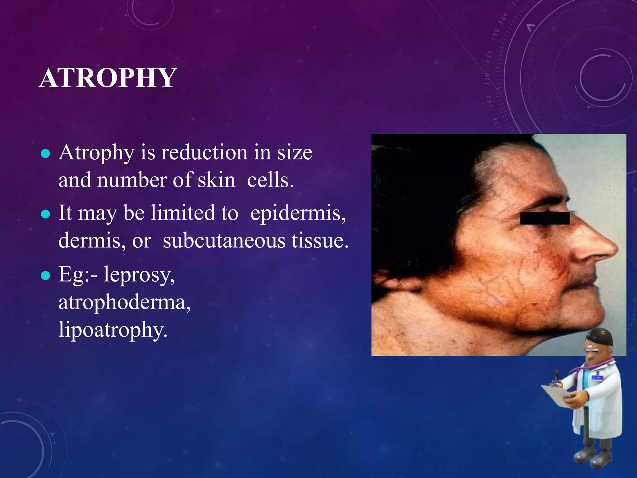 Description of basic skin lesions | PPTX