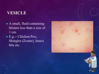 Description of basic skin lesions | PPTX