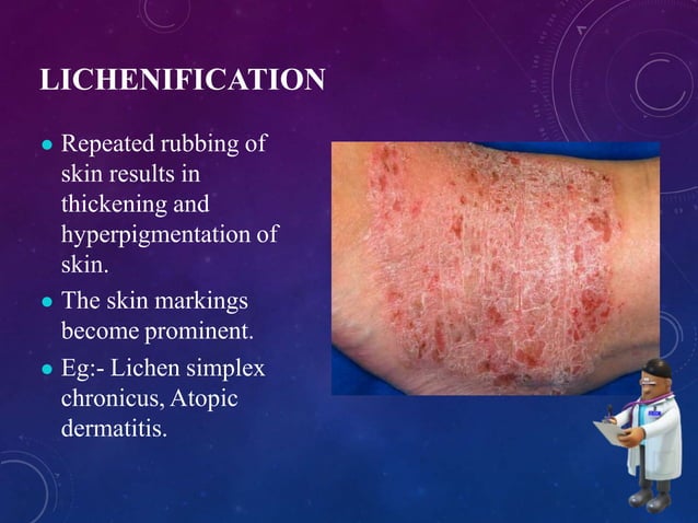 Description of basic skin lesions | PPTX | Skin and Dermatology ...