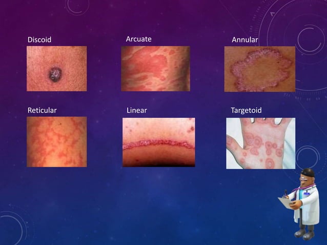 Description of basic skin lesions | PPTX | Skin and Dermatology ...