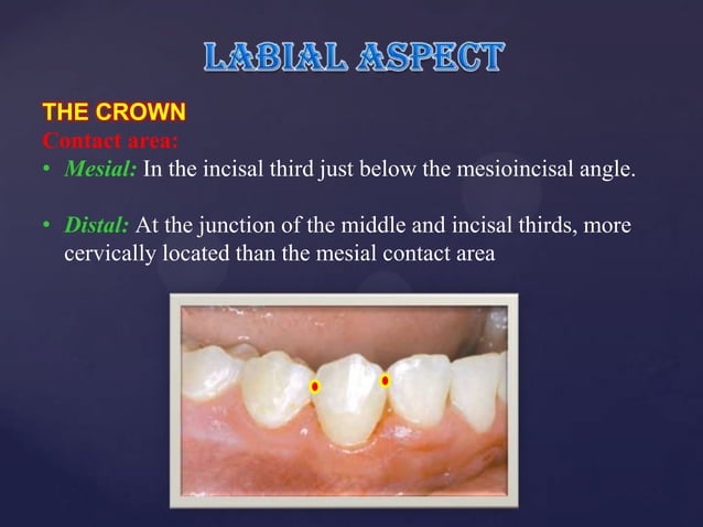 Descriptive anatomy of max and man canine | PPSX | Dental Health ...