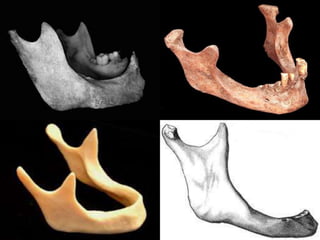 The mandible at different ages and importance of proximal spaces | PPTX