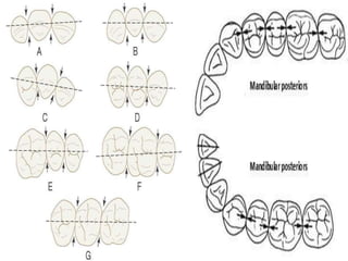 The mandible at different ages and importance of proximal spaces | PPTX