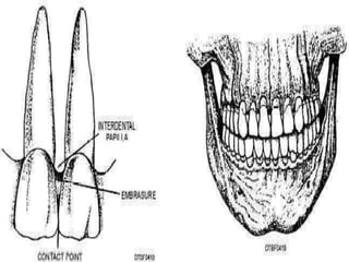 The mandible at different ages and importance of proximal spaces | PPTX