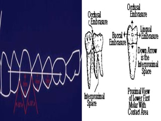 The mandible at different ages and importance of proximal spaces | PPTX