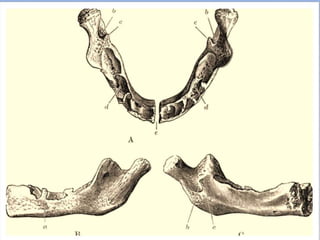 The mandible at different ages and importance of proximal spaces | PPTX