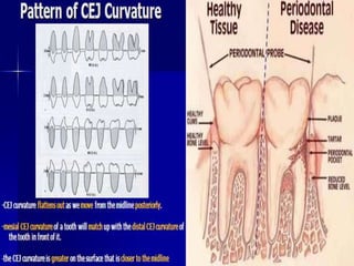 The mandible at different ages and importance of proximal spaces | PPTX
