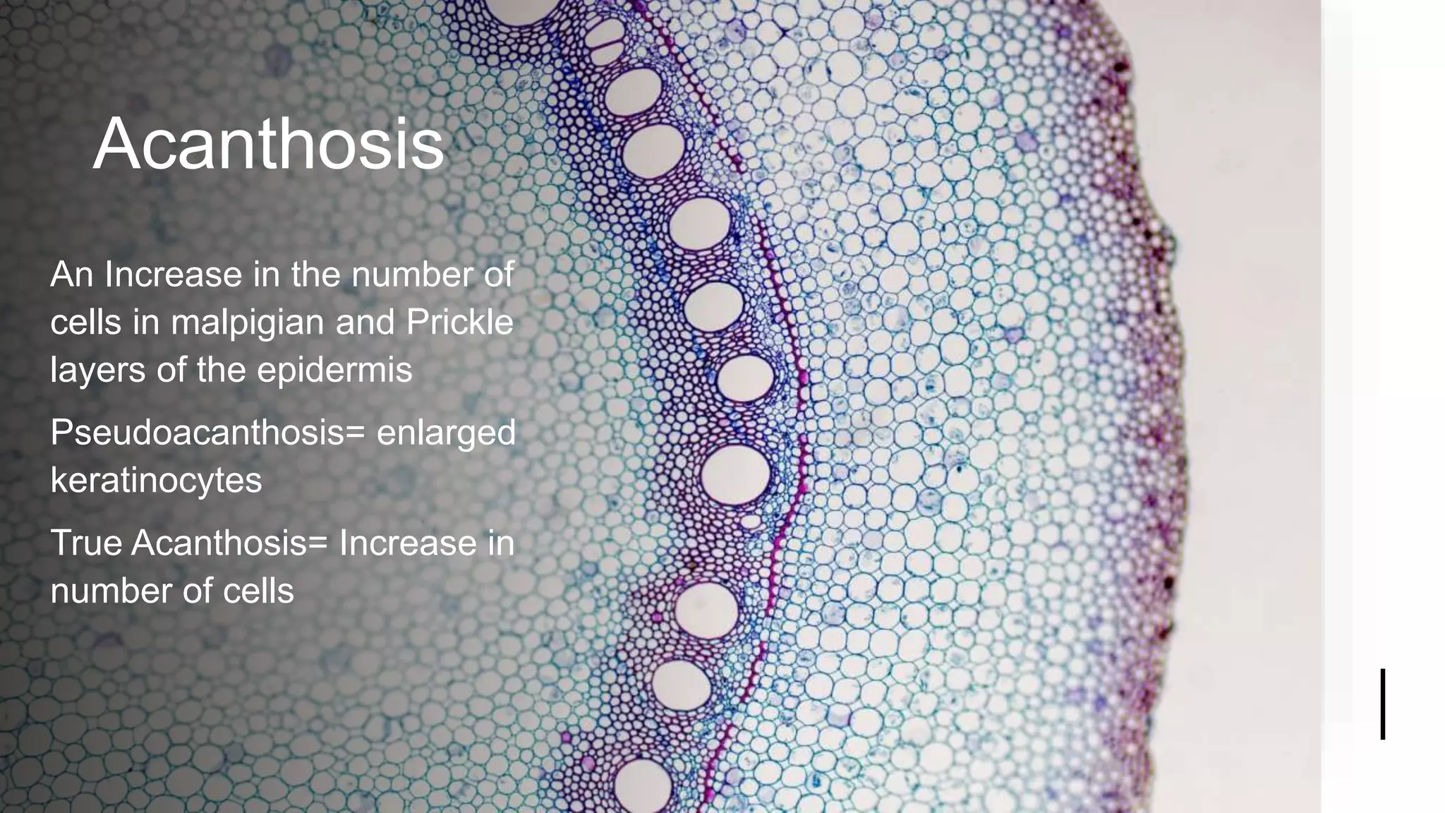 Descriptive terms of dermatopathology | PPTX