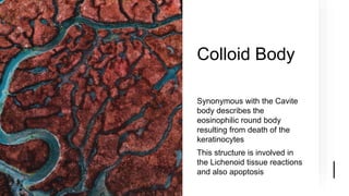Descriptive terms of dermatopathology | PPTX
