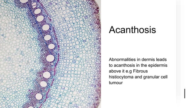 Descriptive terms of dermatopathology | PPTX