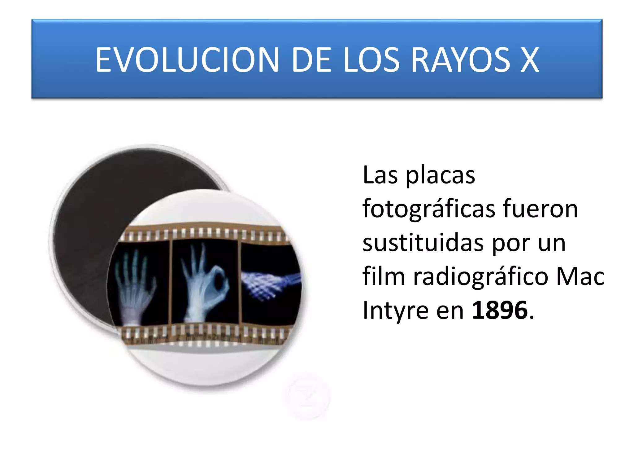 Descubrimiento de los rayos x y evolución | PPT