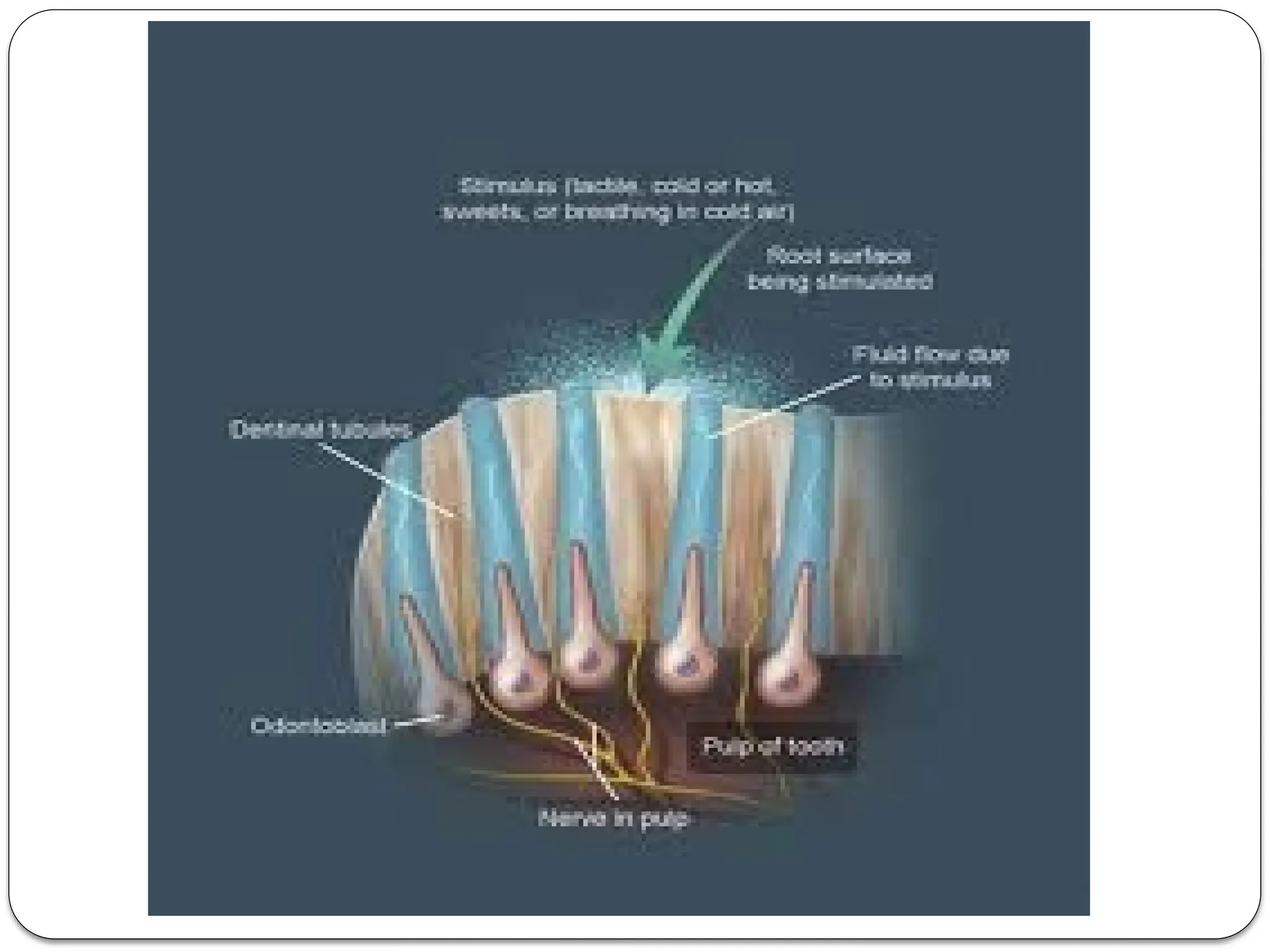 Desensitizing Agents in Periodontics for sentivity | PPTX
