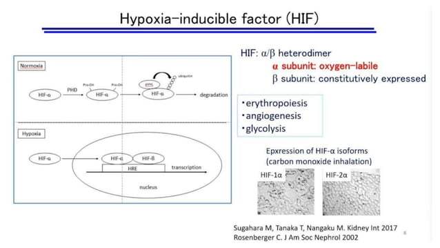 Desidustat the rise of a new dawn - role in treatment of ckd anemia ...