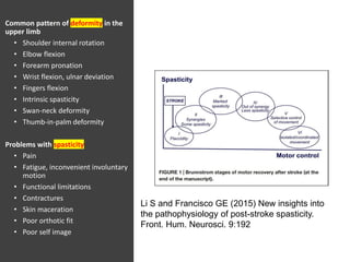 Design and development of a stroke hand service | PPT
