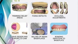 Design and fabrication of complete dentures using cad | PPTX