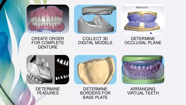 Design and fabrication of complete dentures using cad