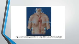 Determination of Cardiac Output based on Minimally Invasive Impedance ...